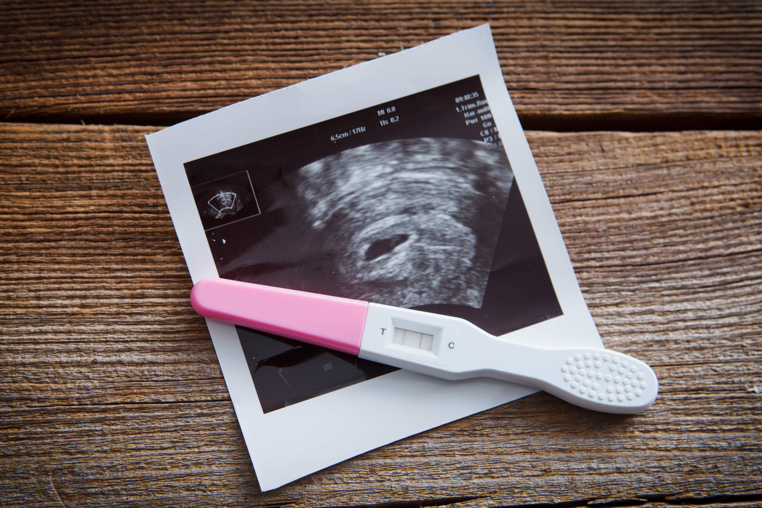 How To Stay Healthy During Gestation - Viera Fertility